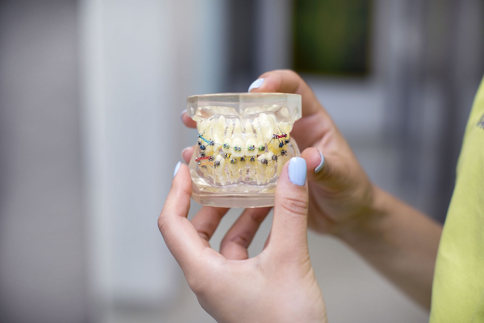 Aparat dentar Invisalign - soluție de tratament ortodontic